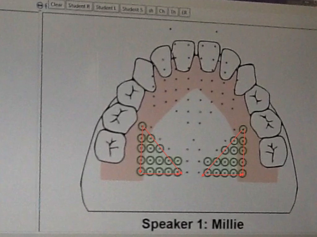 Correct Sound Placement; Connect the Dots ~ Hopuble