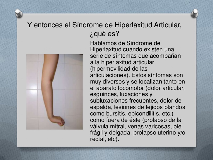 REEDUCACIÓN POSTURAL Y DE MOVIMIENTO : SÍNDROME DE HIEPERLAXITUD/ GENU ...