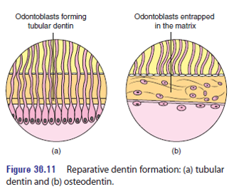 Dentin- Microscopic Structure, Properties, Types and Functions
