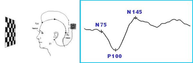 Cátedra N° 06 - Evaluación AV en niños y fijación