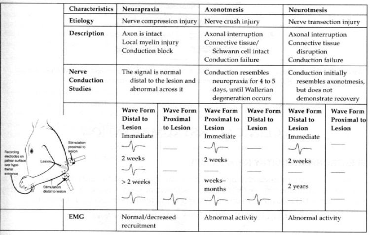RHB and Physical Medicine: Nerve injury classification