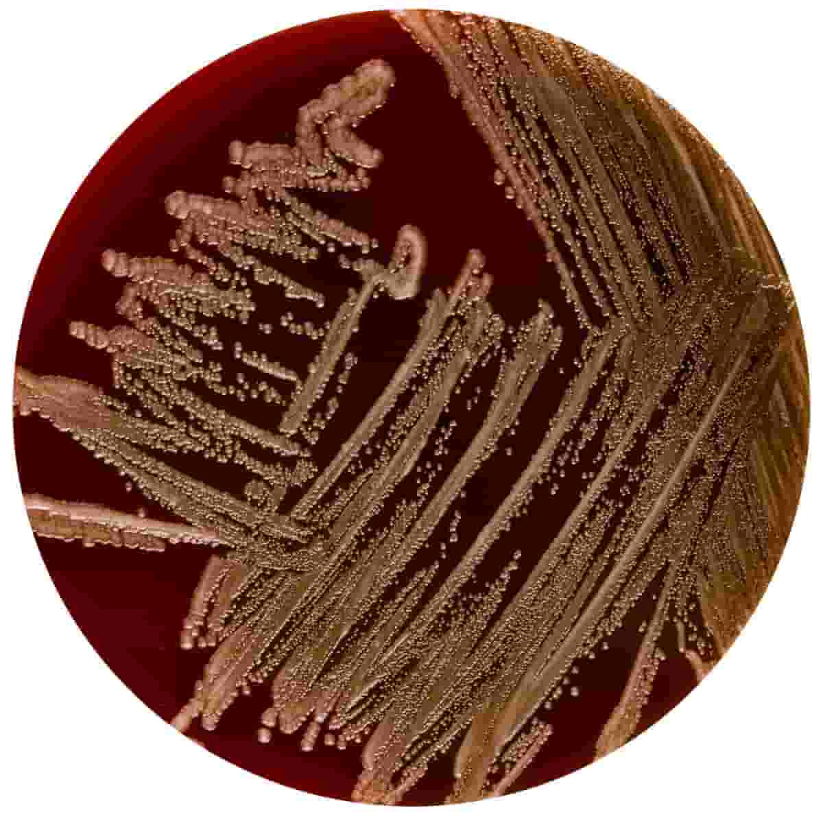 Caso de peste humana no Colorado - USA