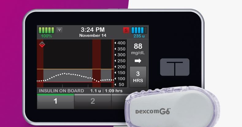 Things to Ponder: Healthy Living as a Type 1 Diabetic: Tandem X2 ...