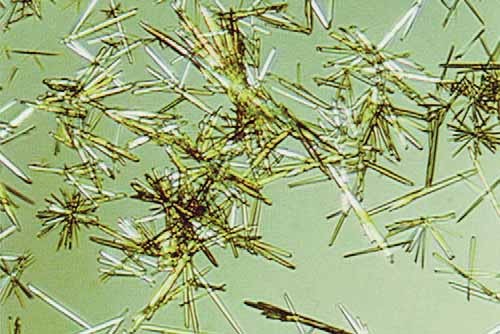 [Haematology] Microscopic Examination of Urinary Sediment - Crystals ...