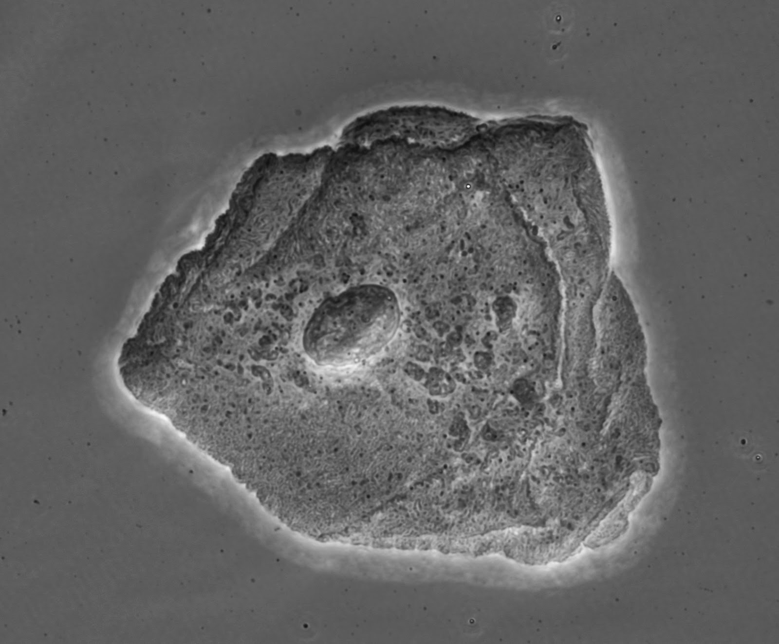 Cheek Cell Under Microscope