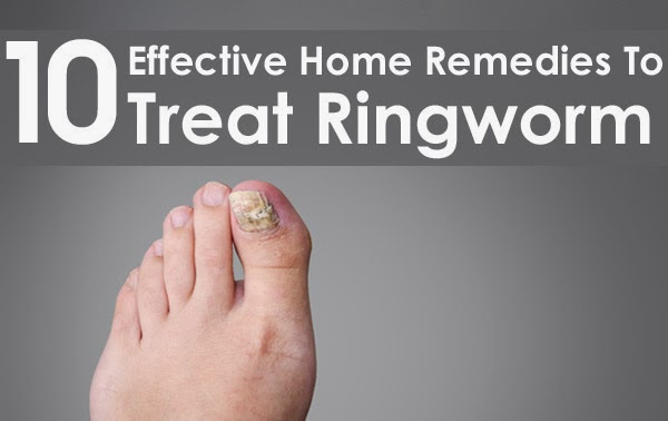 10 Effective Home Remedies To Treat Ringworm ~ Mzizi Mkavu