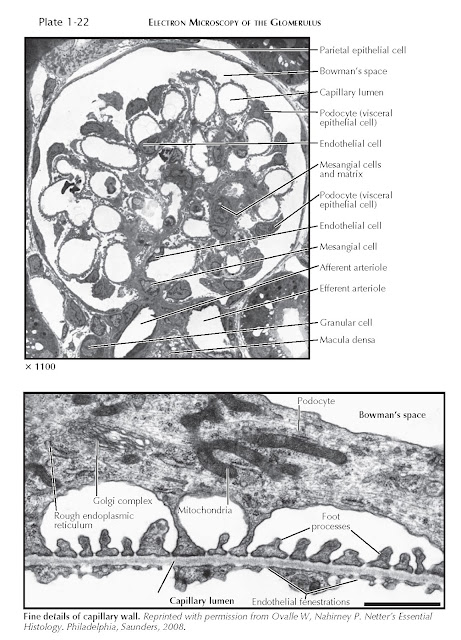 Glomerulus - pediagenosis