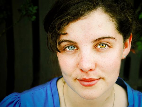 Heterocromia: a beleza dos olhos multicoloridos - Brasil Universo Digital