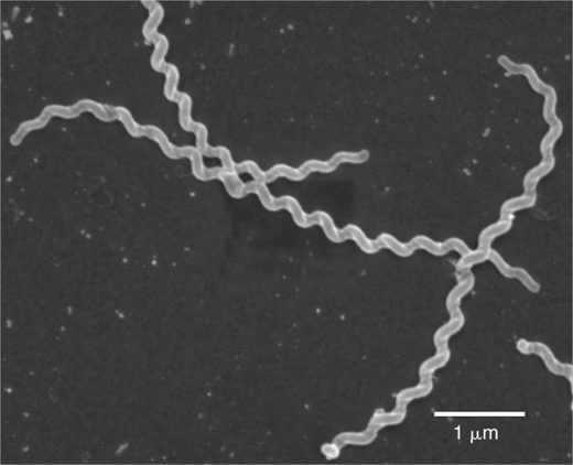 Leptospira - Alchetron, The Free Social Encyclopedia