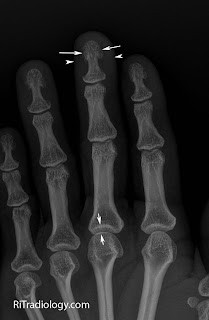 RiT radiology: April 2011