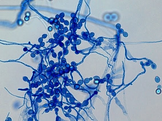 Fun With Microbiology (What's Buggin' You?): Scopulariopsis brevicaulis