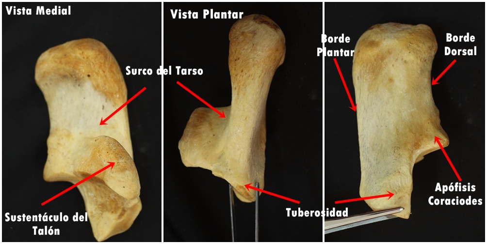 Osteologia: El Tarso ESPECIE: EQUINO | Anatomía :Grupo 7 . Facultad de ...