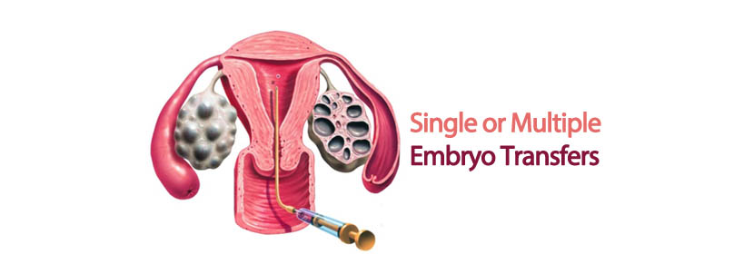EMBRYO TRANSFER: The number of embryos transferred
