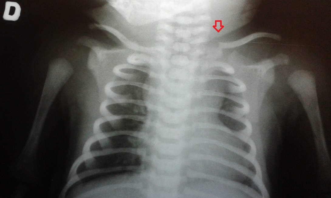 DICAS DE RADIOLOGIA - Tudo Sobre Radiologia: IMAGENS RADIOLÓGICAS ...