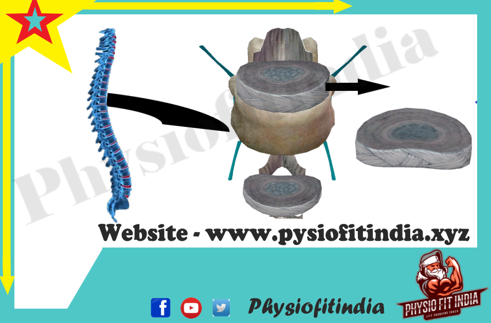 Orthopaedic MCQ in spine conditions PIVD aand Amputation #17 MPT ...