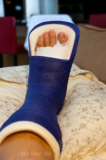 casts and feet (and more...)