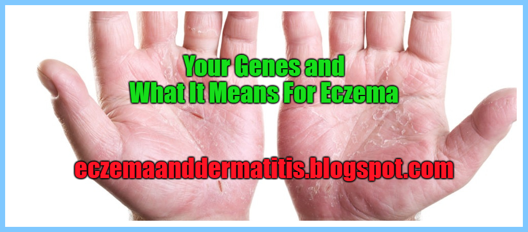 Your Genes and What It Means For Eczema - Eczema and Dermatitis