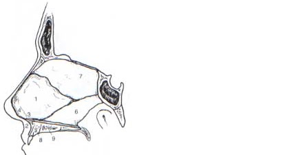 Nose Revision Surgery and Surgeons: Deviated Septum vs Crooked Nose