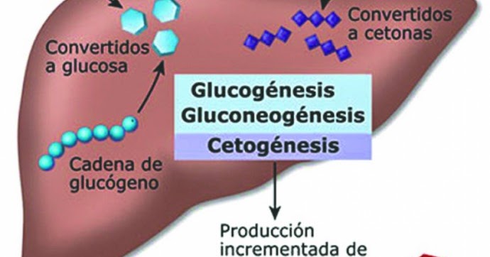 Cetoacidosis Diabética | Diagnostico Medico