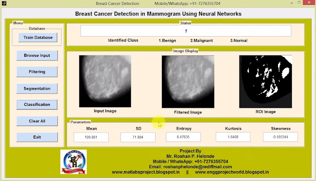 Breast Cancer Detection and Classification Using Neural Network Matlab ...