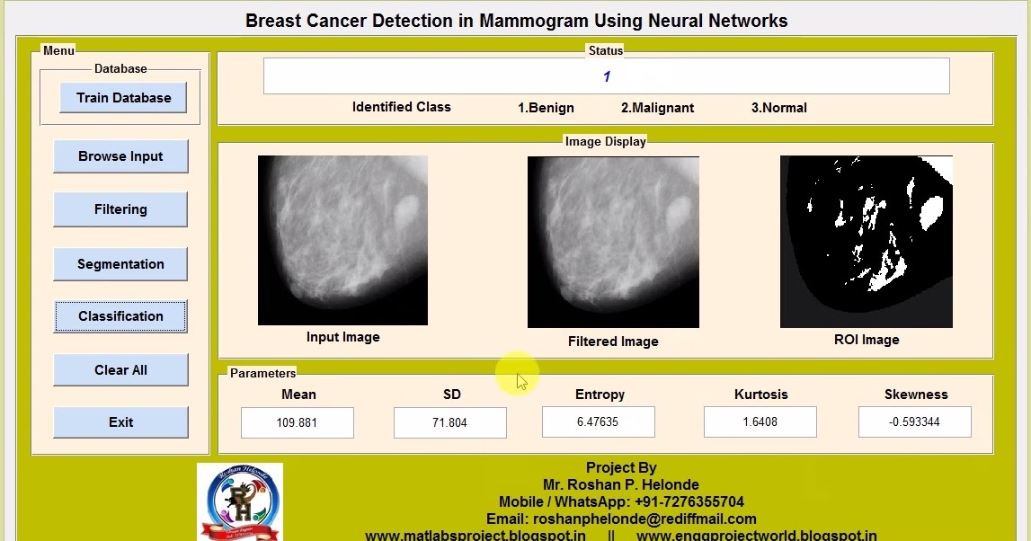 Breast Cancer Detection And Classification Using Neural Network Matlab