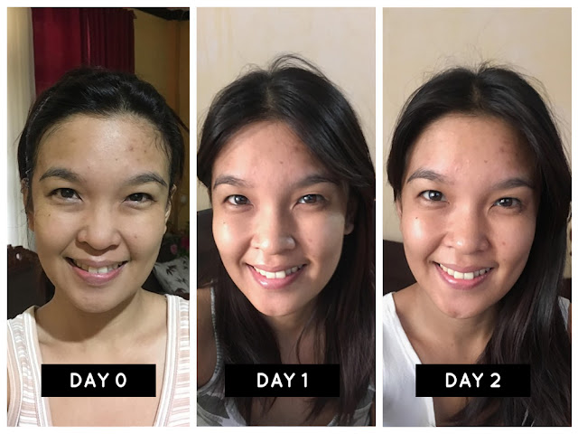 7-Day Skincare Challenge + Results - Sar Writes