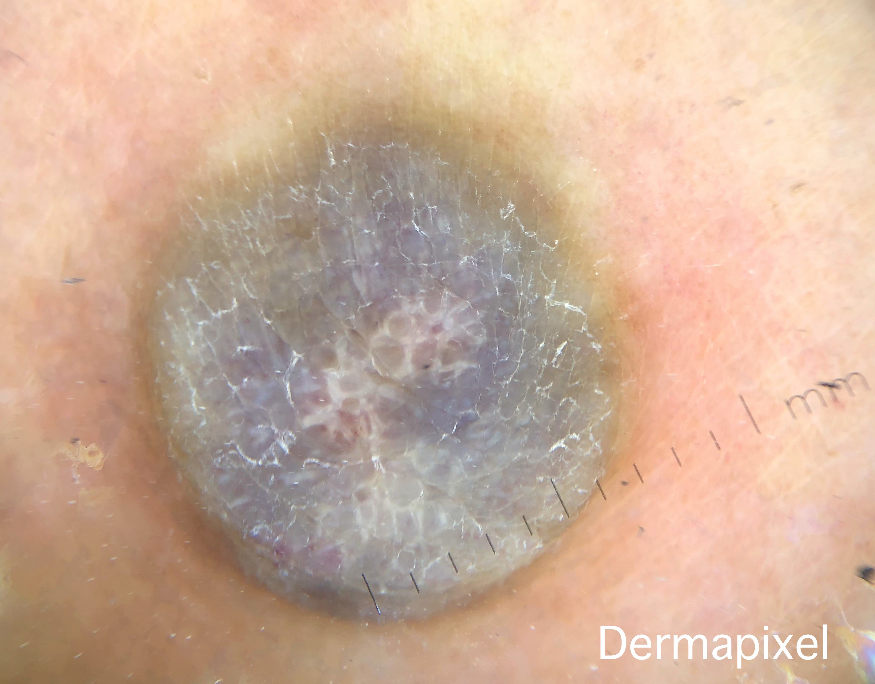 Dermapixel: abril 2021