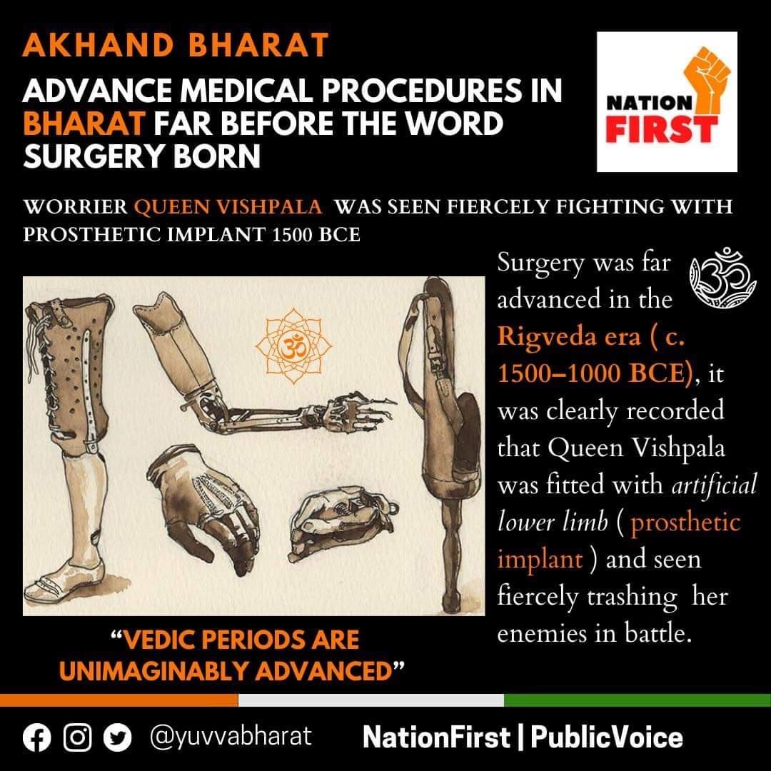 DECODINGHINDUISM.COM: Vishpala- Ancient medical procedure in India