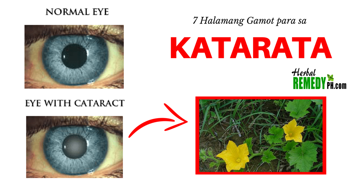 7 Halamang Gamot para sa Katarata