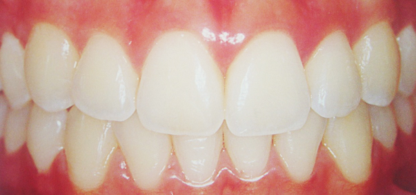 Dentisterie Clínica Odontológica: Doença Periodontal - Parte 1