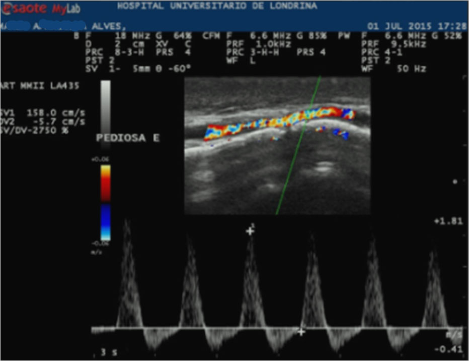 Ultrassonografia Vascular