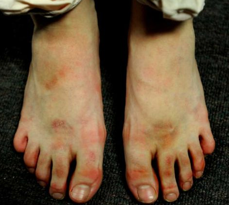 Pointe Shoe Feet