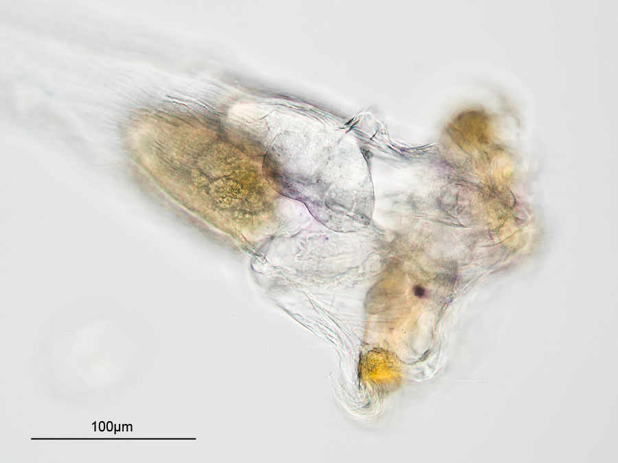 明石・神戸の虫 ときどきプランクトン2: 海産のドロワムシ属の一種（Synchaeta sp.）