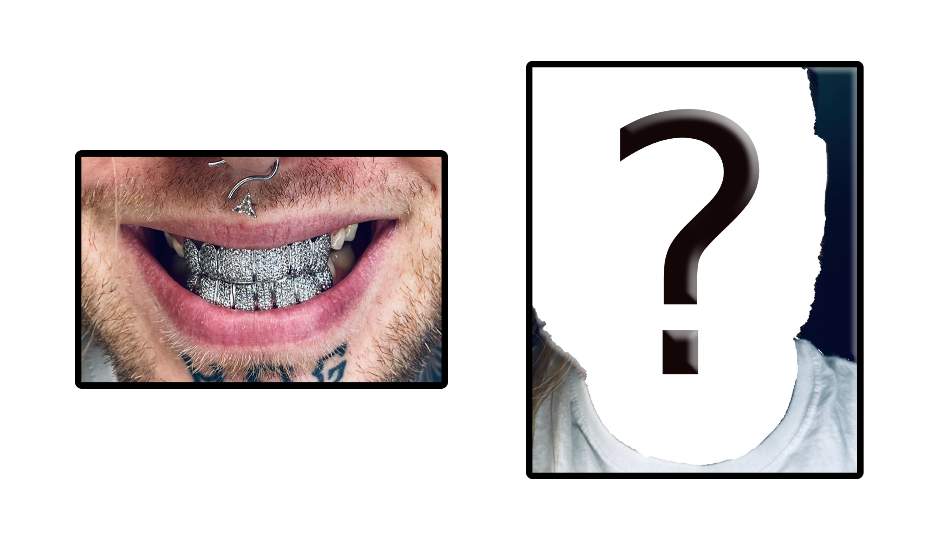 Guessing whose celebrities' teeth are in the picture / Arvuutellaan ...