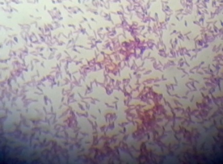 KLIMAKS: Bakteri GRAM + Batang