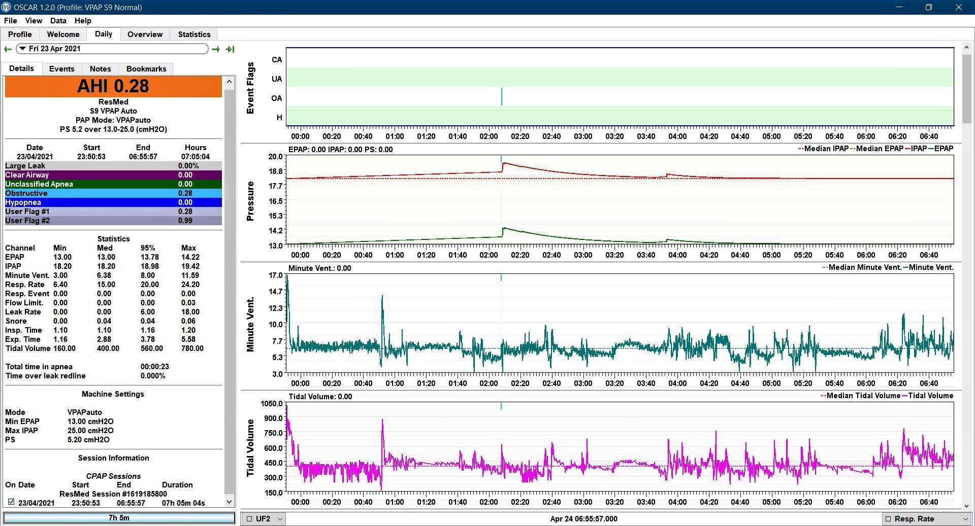 CPAP Health Issues: Stop Alzheimer's Dementia using BiPAP with AVAPS or ...