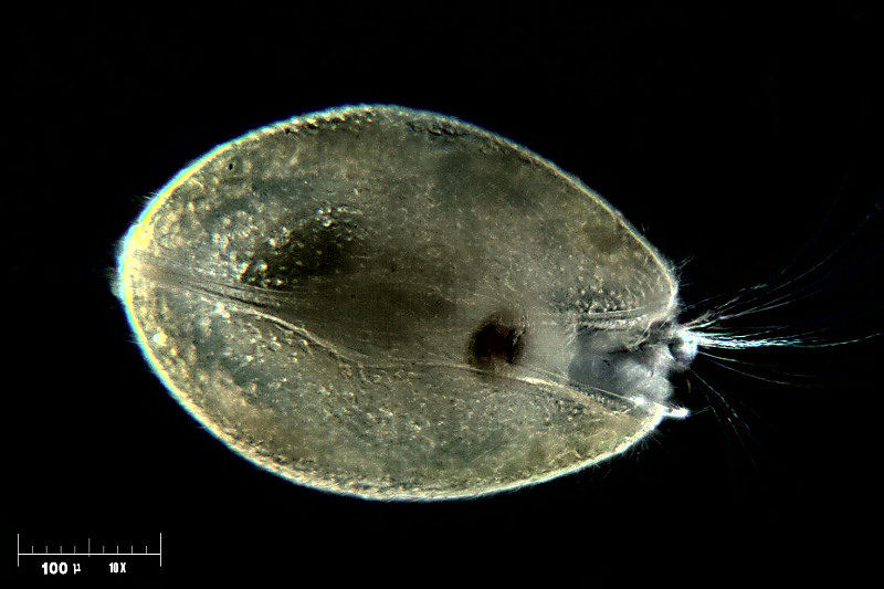 Real Monstrosities: Ostracod