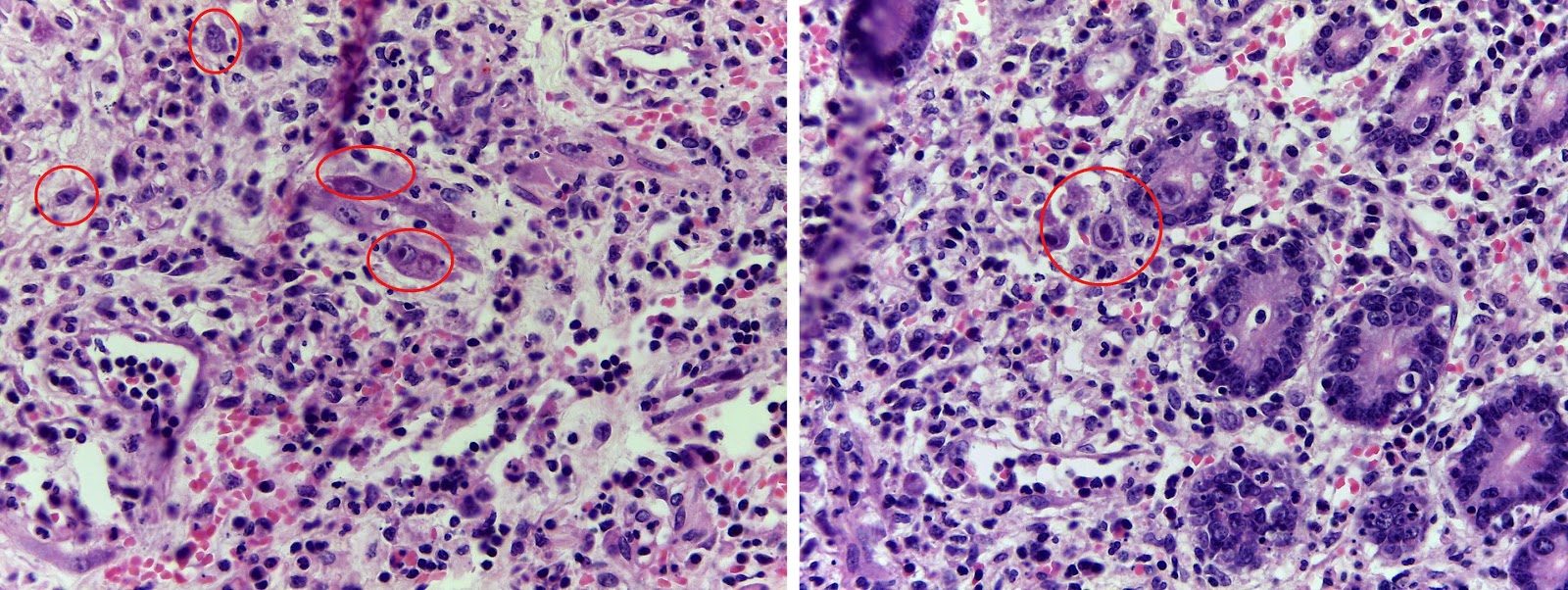 GASTROINTESTINAL AND LIVER HISTOLOGY PATHOLOGY ATLAS: ILEUM ...