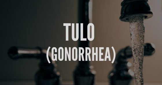 Nurse Rachel is Online: Ano ang Pinaka-Mabisang Gamot sa Tulo?