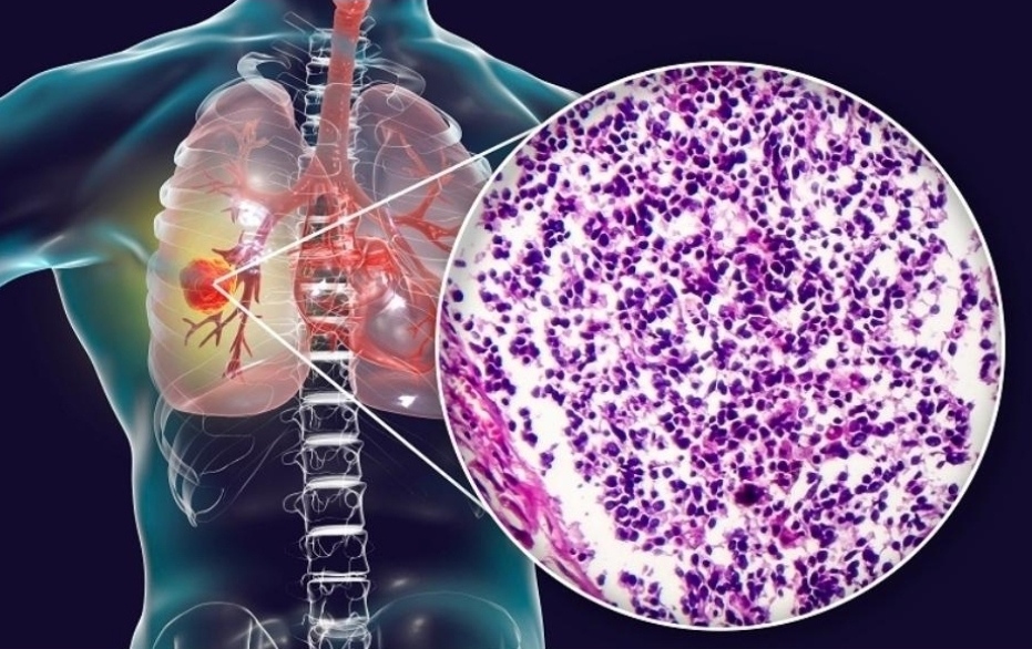 GRIFOLS EN MENOS DE 39 DIAS LLEVARA A CABO UNA OPERACIÓN DE ...