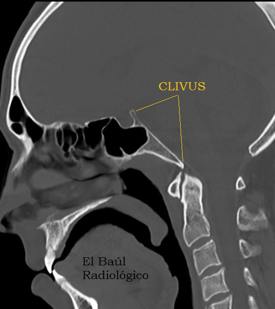 ANATOMÍA: Tejido óseo. EL CRÁNEO. TC, TAC, Rx, RADIOGRAFÍA.