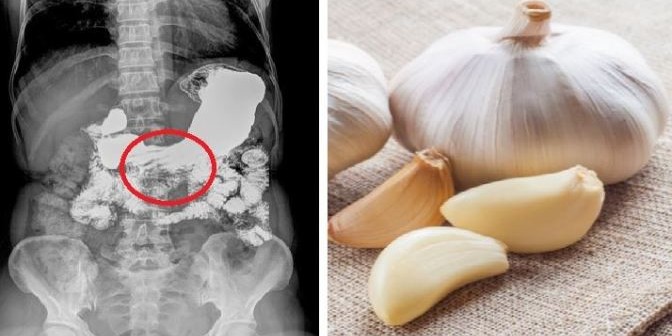 See What Happens When You Eat Garlic On an Empty Stomach : FUNKKY DRESS|