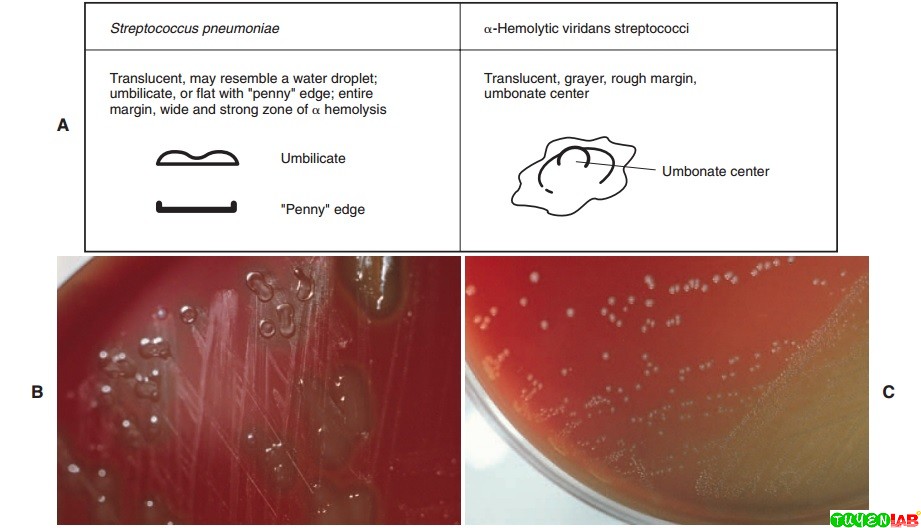 [Microbiology] Use of Colonial Morphology for the Presumptive ...