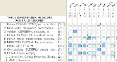 Brain Atrophy Homeopathic Treatment « Use Homeopathy And Be Healthy