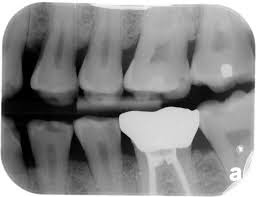 DentDesk: Radiographic Faults