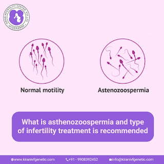 What is asthenozoospermia and type of infertility treatment that is ...