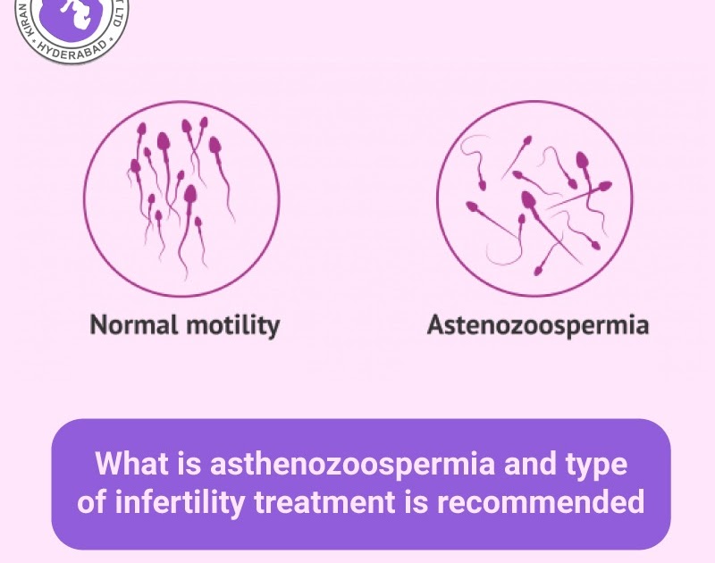 What is asthenozoospermia and type of infertility treatment that is ...