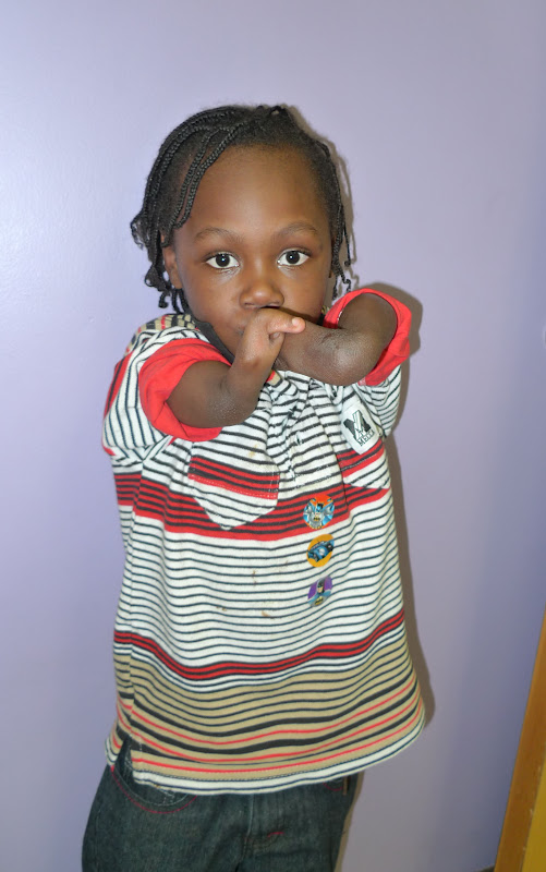 Great Function in Ulnar Deficiency | Congenital Hand and Arm ...