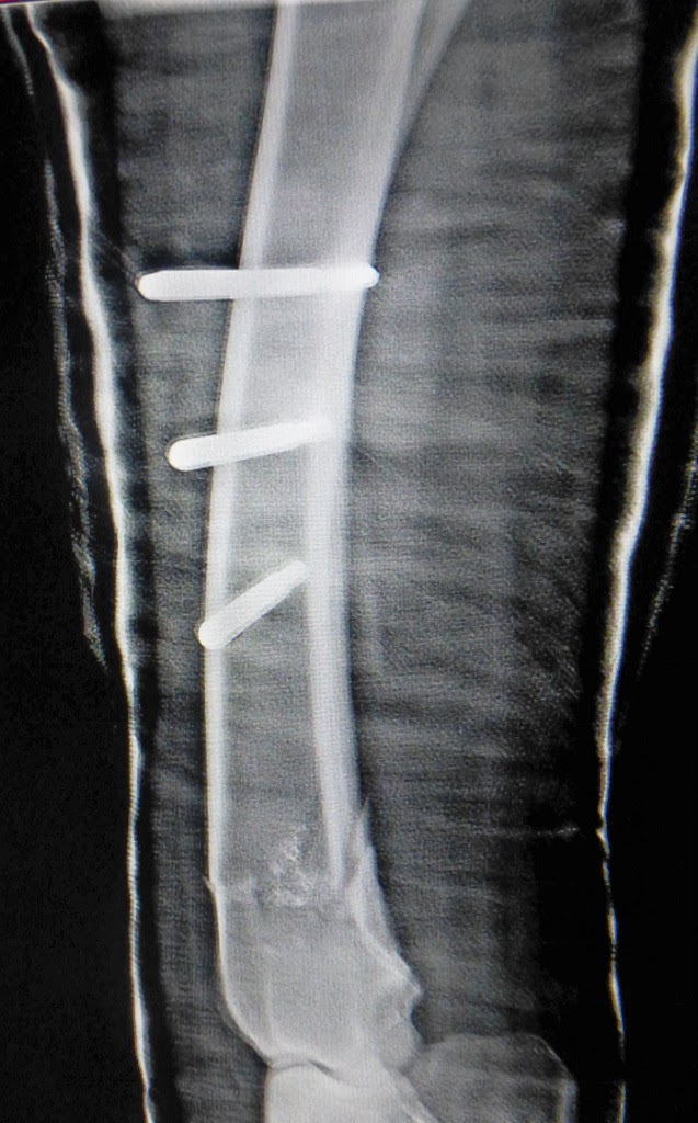 Wellington son combat pour la vie: EXPLICATIONS SUR LA TRANSFIXATION ...