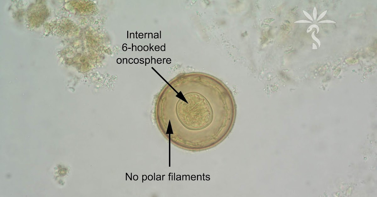 Creepy Dreadful Wonderful Parasites: Answer to Case 559